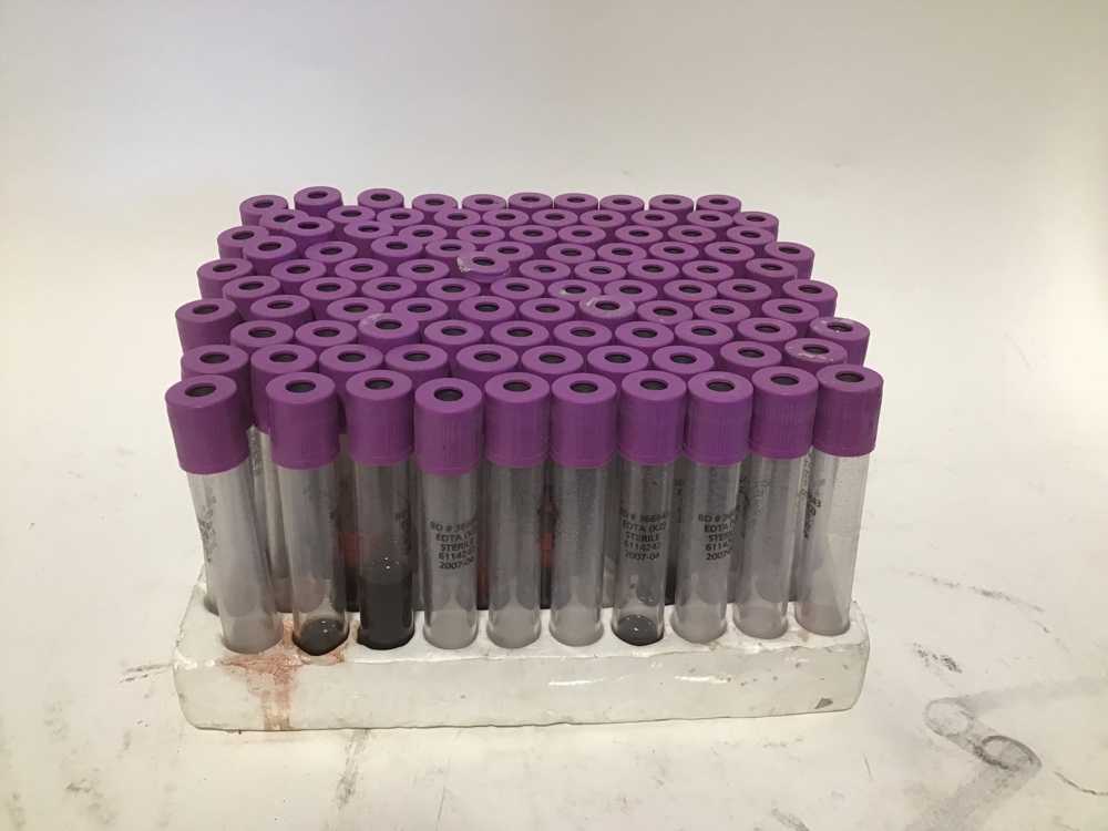Vacutainer Vials With Plastic Lid In Styrofoam Tray, 100 Vials Total