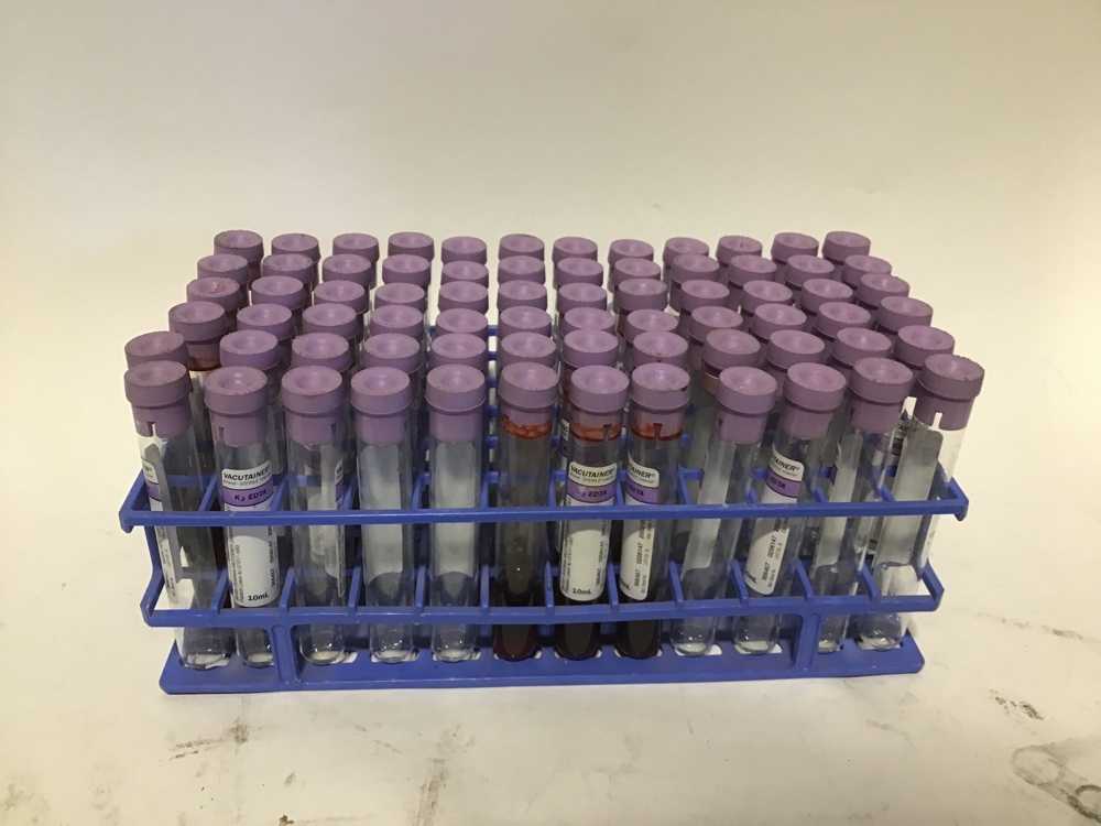 Vacutainer Vials With Plastic Lid In Plastic Tray, 72 Vials Total